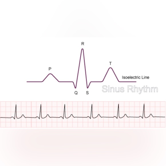 Boutique | Jewelry | Ekg Heart Ecg Electrocardiogram Heartbeat Sinus ...